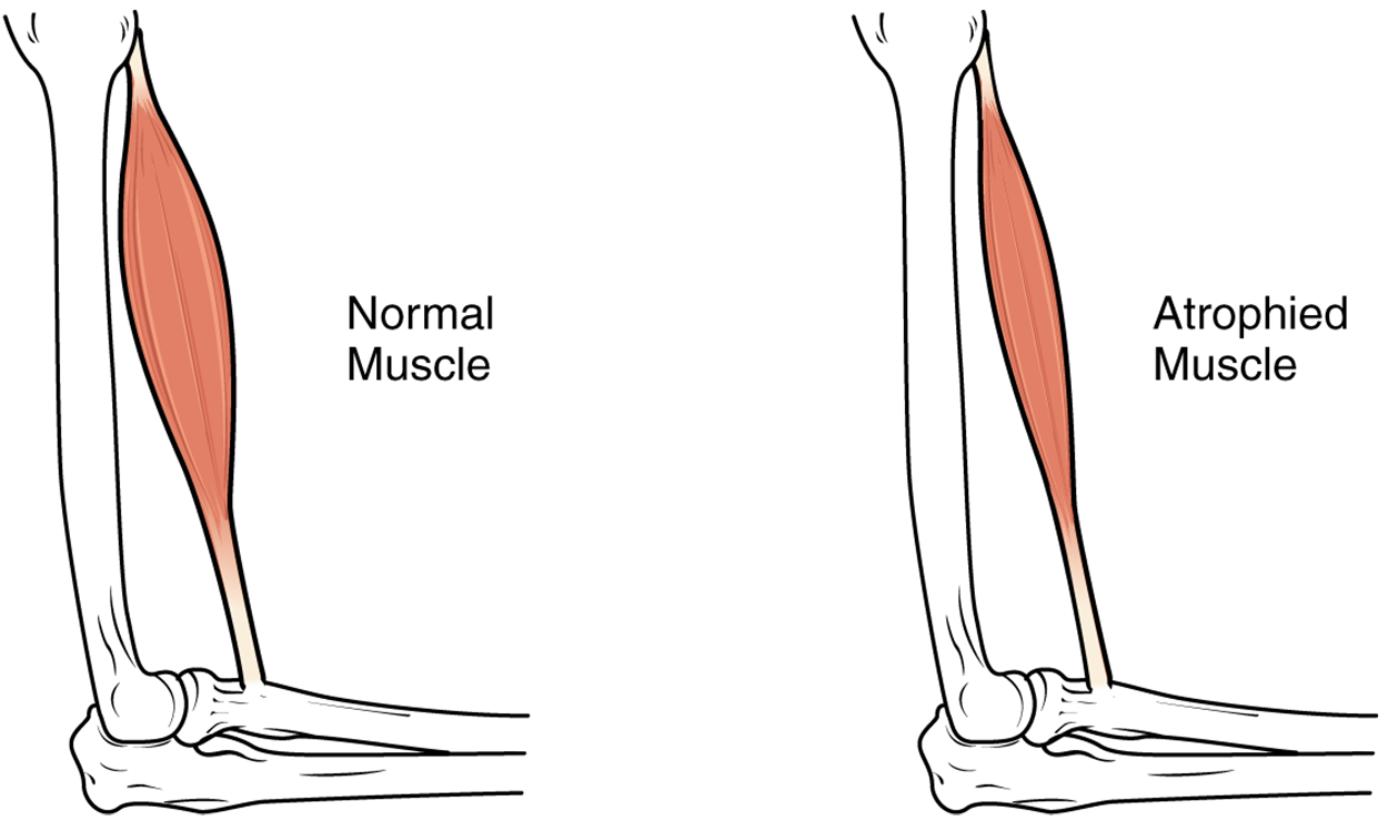 Resistance Exercise and Muscle Performance Tutorial | Sophia Learning