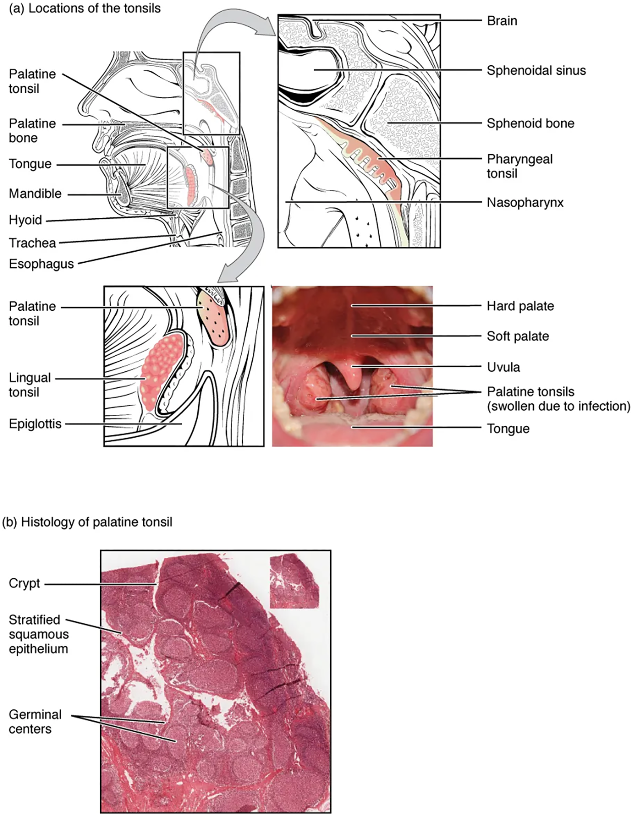 Lymphatic System: Secondary Organs and Tissues Tutorial | Sophia Learning