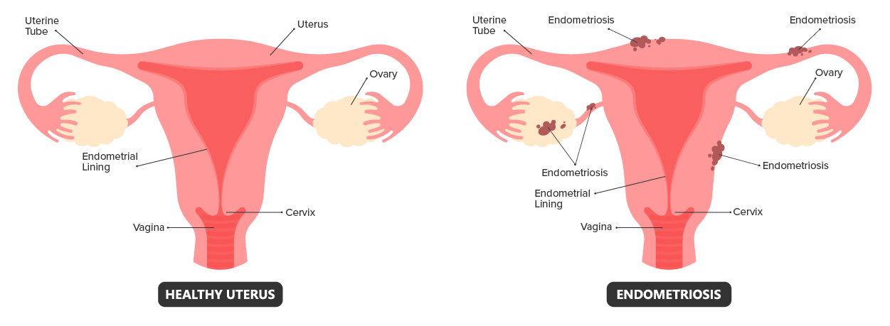 The Female Reproductive Cycle: Uterine Cycle Tutorial | Sophia Learning