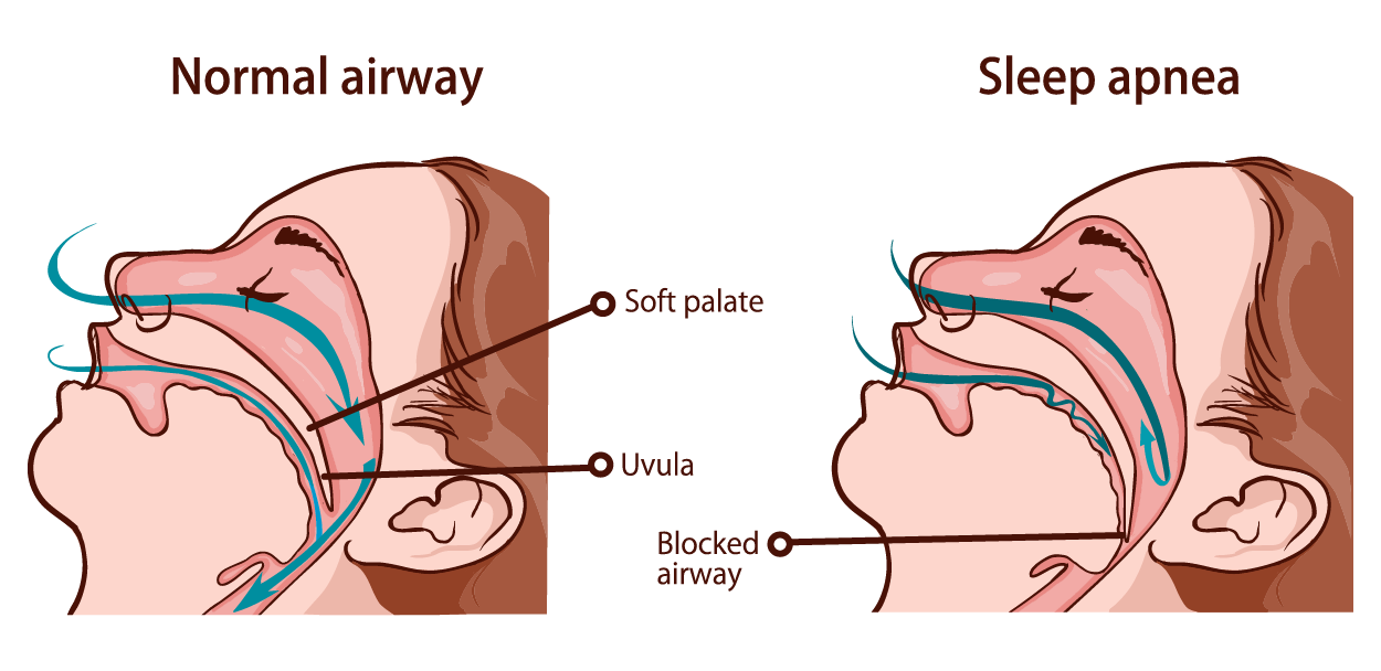 Respiratory Health and Disorders Tutorial | Sophia Learning