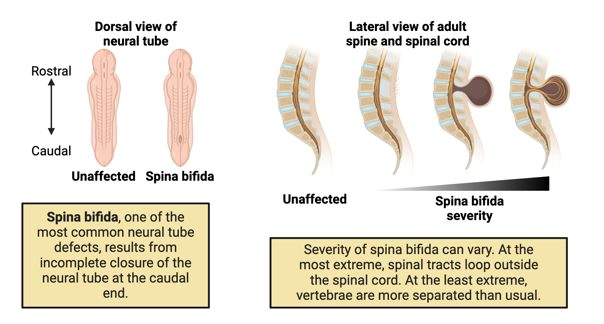 Birth Defects Tutorial | Sophia Learning