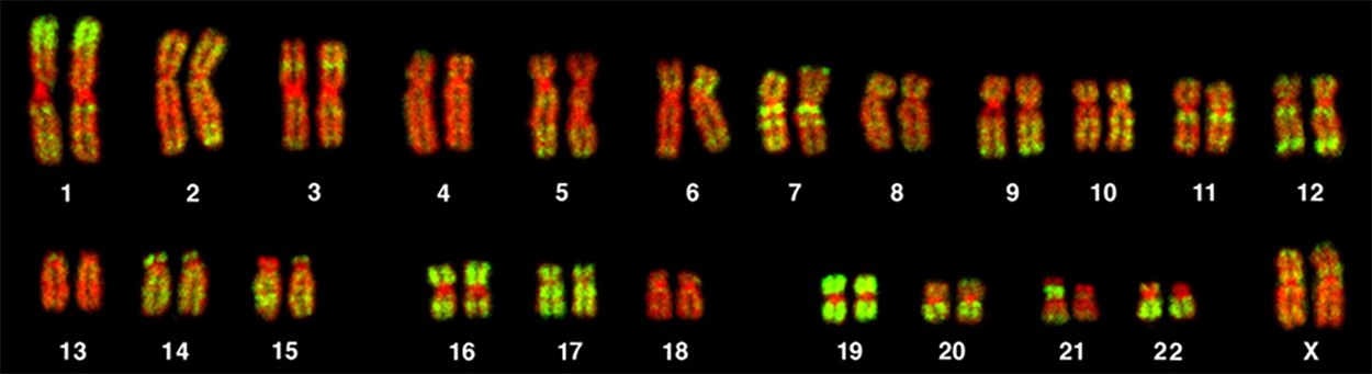 Chromosome Changes Tutorial | Sophia Learning