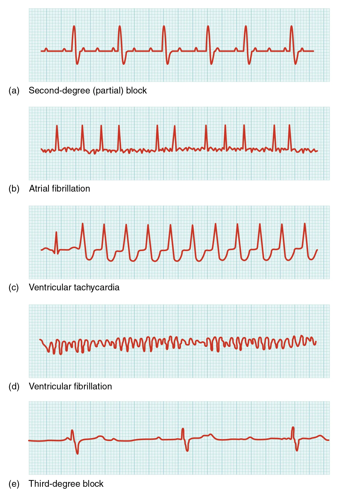 Conduction System of the Heart Tutorial | Sophia Learning